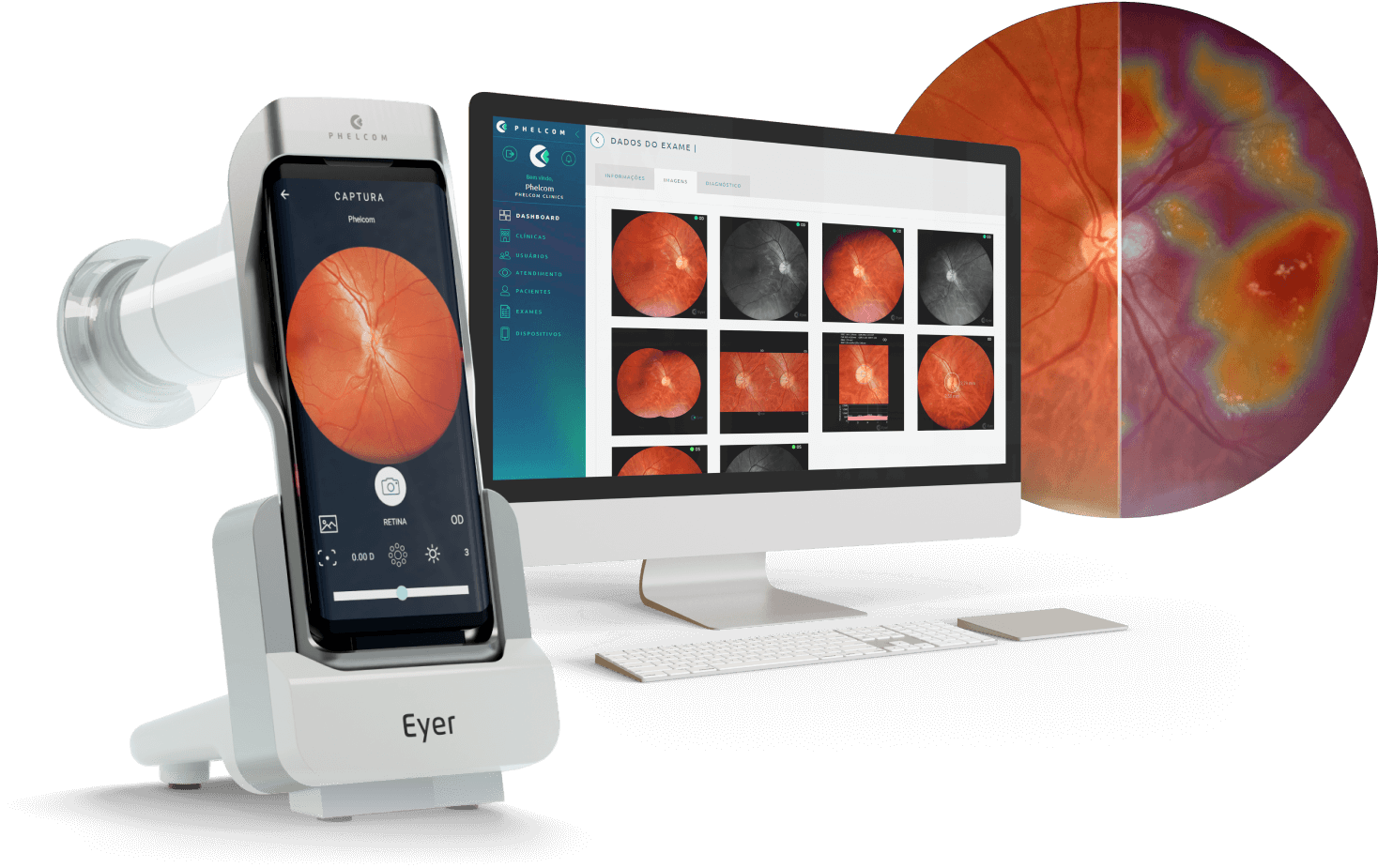 Eyer Exam Suite - PHELCOM Technologies