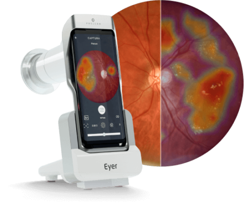 Eyer Exam Suite - PHELCOM Technologies