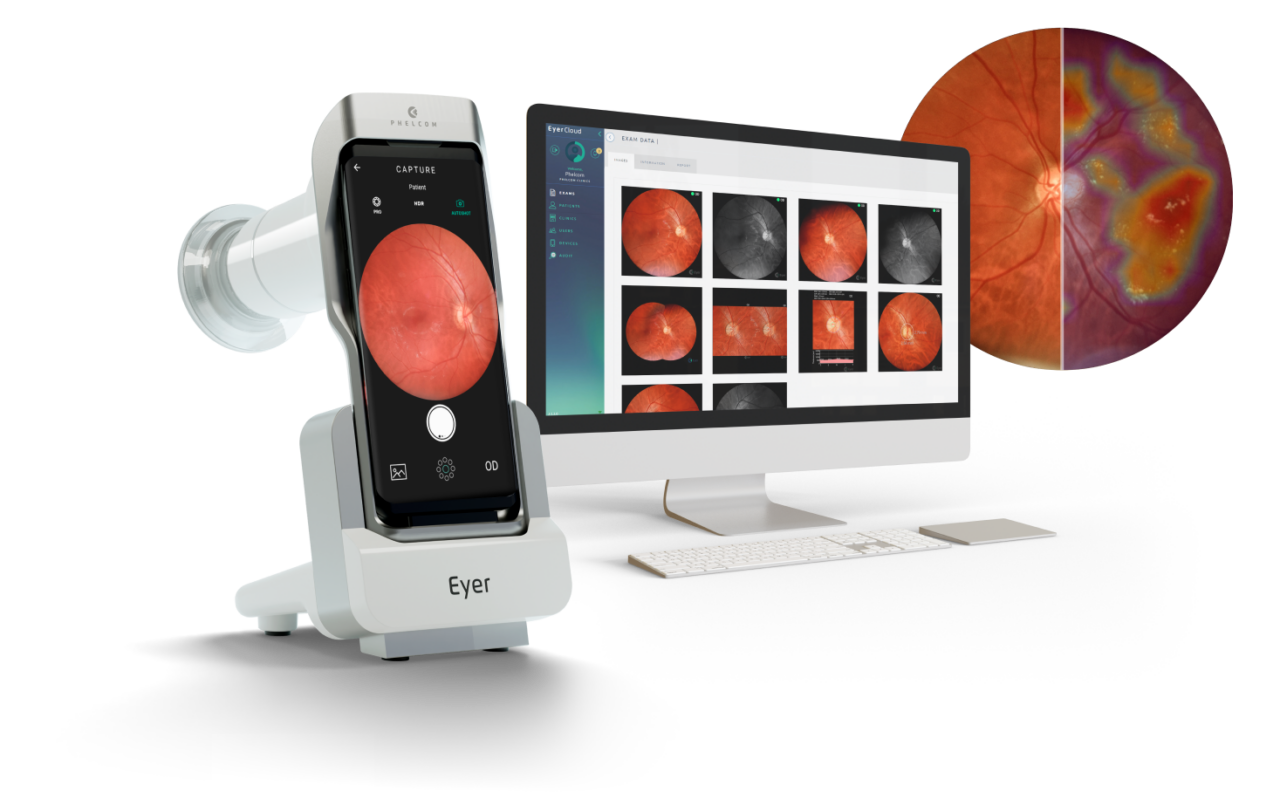 Eyer Exam Suite - PHELCOM Technologies