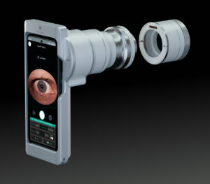 Meibografia: auxílio valioso no diagnóstico de olho seco - PHELCOM Technologies