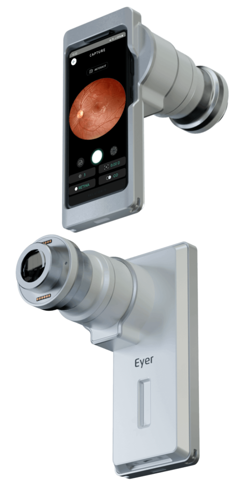 Eyer2 Basic - PHELCOM Technologies